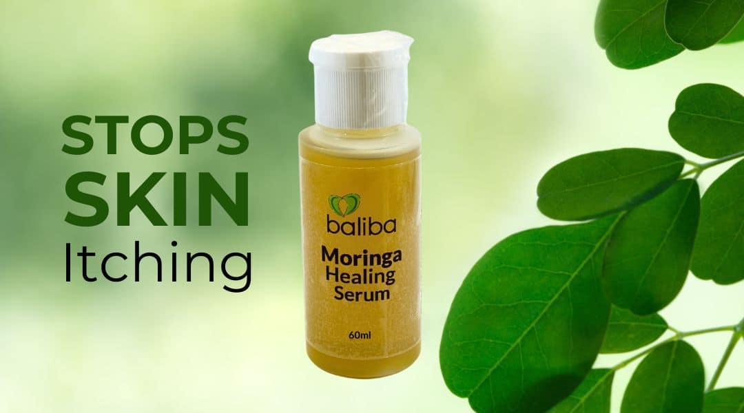 Moringa Healing Serum (for extremely inflamed skin) 60ml | Baliba NZ